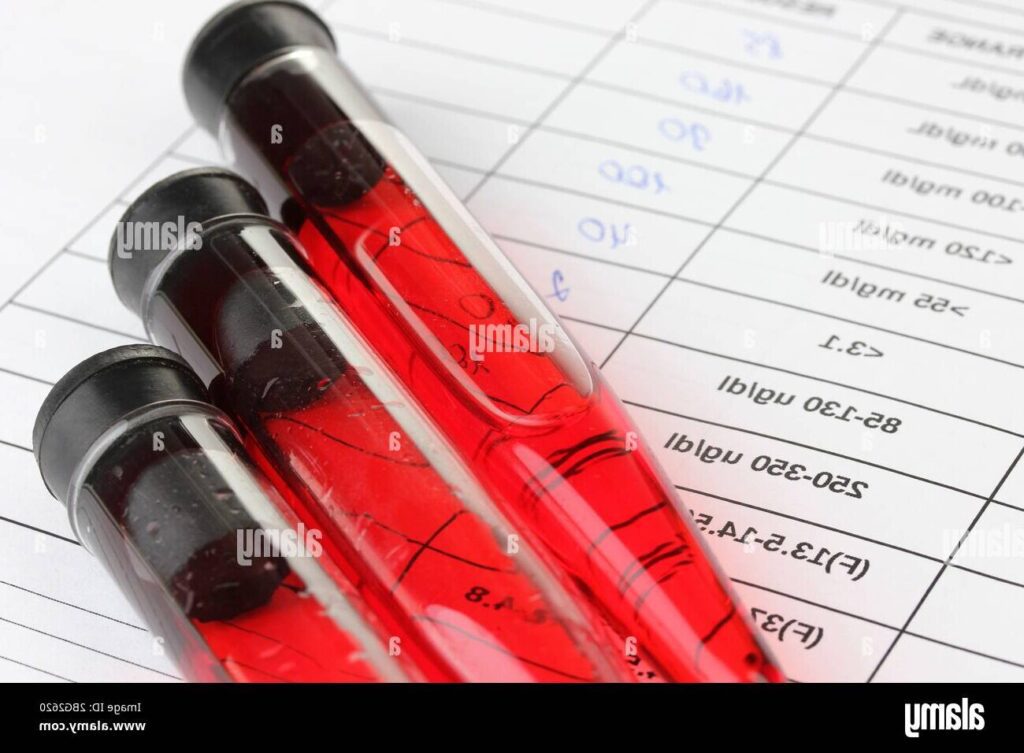 Cuánto tiempo tarda en descomponerse la sangre